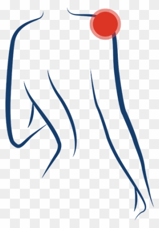 Rotator Cuff Injury Clipart (#3692093) - PinClipart
