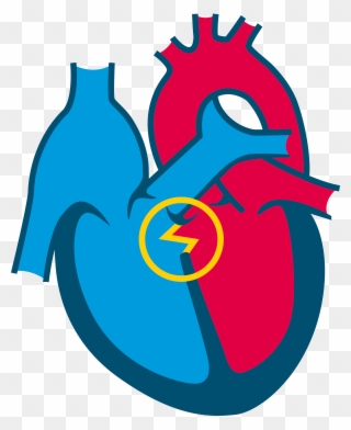 Muscular Vsd Clipart (#3819538) - PinClipart